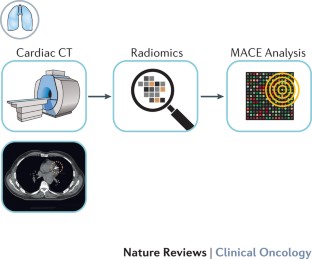 Radiomics: the bridge between medical imaging and personalized medicine ...