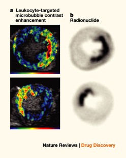 Microbubbles in medical imaging: current applications and future ...