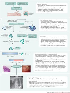 Clostridium difficile infection: epidemiology, diagnosis and ...