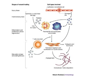 Fibrotic disease and the T H 1/T H 2 paradigm | Nature Reviews Immunology