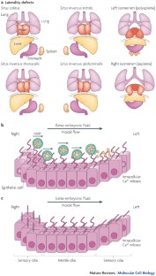When cilia go bad: cilia defects and ciliopathies | Nature Reviews ...