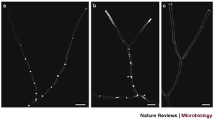 Ashbya gossypii : a model for fungal developmental biology | Nature ...