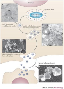Who puts the tubercle in tuberculosis? | Nature Reviews Microbiology