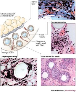 Who puts the tubercle in tuberculosis? | Nature Reviews Microbiology