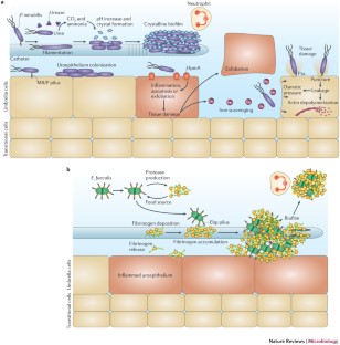 Urinary tract infections: epidemiology, mechanisms of infection and ...