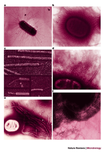 Pathogenic Escherichia coli | Nature Reviews Microbiology