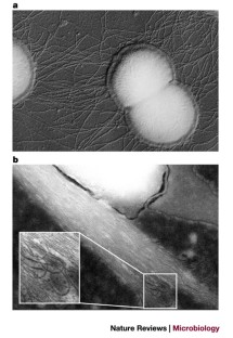 Type IV pilus structure and bacterial pathogenicity | Nature Reviews ...