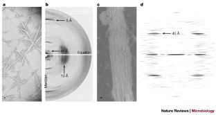Type IV pilus structure and bacterial pathogenicity | Nature Reviews ...