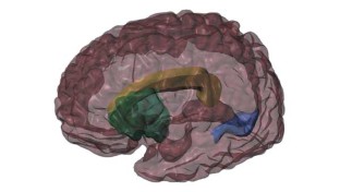 Mapping brain asymmetry | Nature Reviews Neuroscience