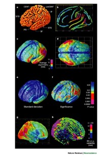 Mapping brain asymmetry | Nature Reviews Neuroscience