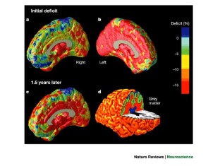 Mapping brain asymmetry | Nature Reviews Neuroscience