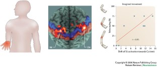 Phantom limb pain: a case of maladaptive CNS plasticity? | Nature ...