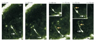 Modes of neuronal migration in the developing cerebral cortex | Nature ...