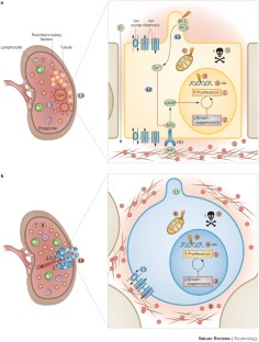 The hallmarks of cancer: relevance to the pathogenesis of polycystic ...