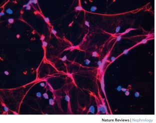 The role of neutrophils and NETosis in autoimmune and renal diseases ...