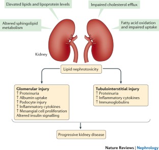 Dyslipidaemia in nephrotic syndrome: mechanisms and treatment | Nature ...