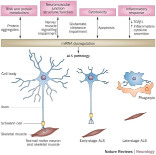 Amyotrophic lateral sclerosis: mechanisms and therapeutics in the ...