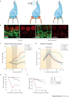 Auditory neuropathy — neural and synaptic mechanisms | Nature Reviews ...