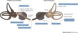 The dizzy patient: don't forget disorders of the central vestibular ...