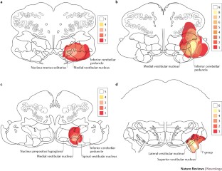 The dizzy patient: don't forget disorders of the central vestibular ...