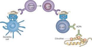 The influence of ACPA status and characteristics on the course of RA ...