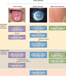 Topical and systemic medications for the treatment of primary Sjögren's ...