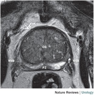 Novel methods for mapping the cavernous nerves during radical ...