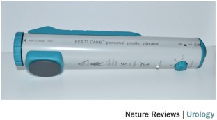 A step-wise approach to sperm retrieval in men with neurogenic ...