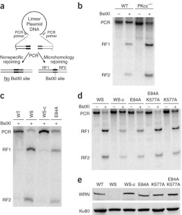 WRN exonuclease structure and molecular mechanism imply an editing role ...