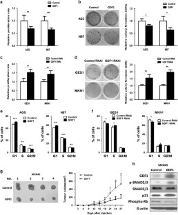 Epigenetic silencing of GDF1 disrupts SMAD signaling to reinforce ...
