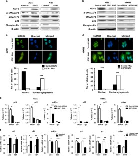 Epigenetic silencing of GDF1 disrupts SMAD signaling to reinforce ...