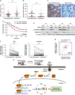 Epigenetic silencing of GDF1 disrupts SMAD signaling to reinforce ...
