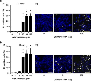 Oncosis and apoptosis induction by activation of an overexpressed ion ...
