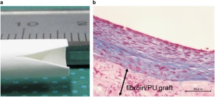 Structures of silk fibroin before and after spinning and biomedical ...