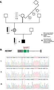 Novel NEXMIF pathogenic variant in a boy with severe autistic features ...