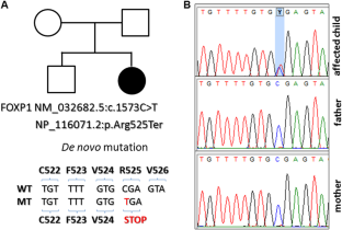 Co-occurrence of mutations in FOXP1 and PTCH1 in a girl with extreme ...