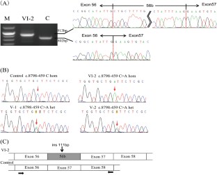 A rare deep intronic mutation of PKHD1 gene, c.8798-459 C > A, causes ...