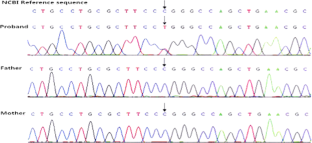 De novo mutations of TUBB2A cause infantile-onset epilepsy and ...