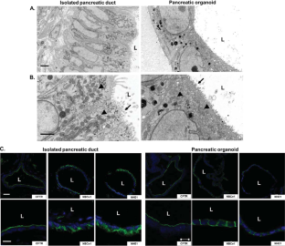 Mouse pancreatic ductal organoid culture as a relevant model to study ...