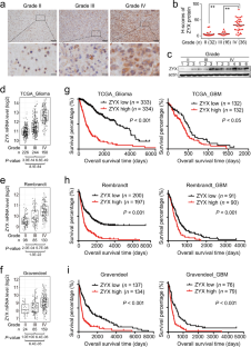 Zyxin ( ZYX ) promotes invasion and acts as a biomarker for aggressive ...