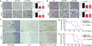 Zyxin ( ZYX ) promotes invasion and acts as a biomarker for aggressive ...