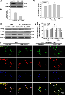 Elk-1 transcriptionally regulates ZC3H4 expression to promote silica ...