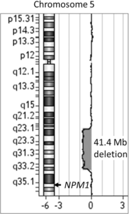 Acute myeloid leukemia with isolated del(5q) is associated with IDH1 ...