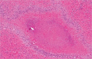 Common and critical inflammatory dermatoses every pathologist should know | Modern Pathology