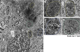 Sequential formation of different layers of dystrophic neurites in ...