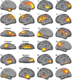 Accelerated cortical thinning within structural brain networks is ...