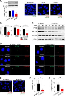 Loss-of-function of IFT88 determines metabolic phenotypes in thyroid ...