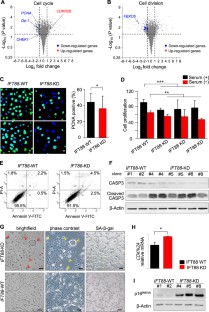 Loss-of-function of IFT88 determines metabolic phenotypes in thyroid ...