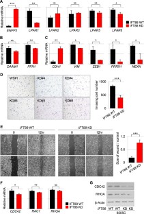 Loss-of-function of IFT88 determines metabolic phenotypes in thyroid ...