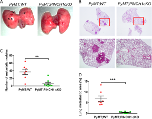 PINCH-1 interacts with myoferlin to promote breast cancer progression ...